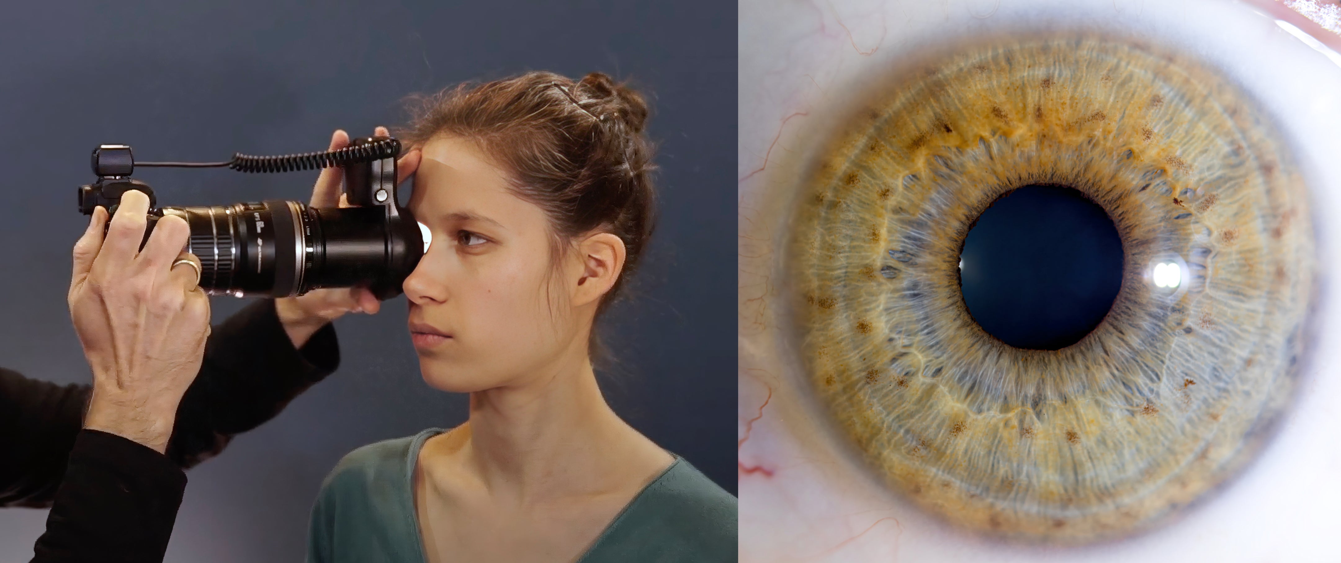 Camera Iriscope | Iridoscope | Iris Lighting | Professional iridology