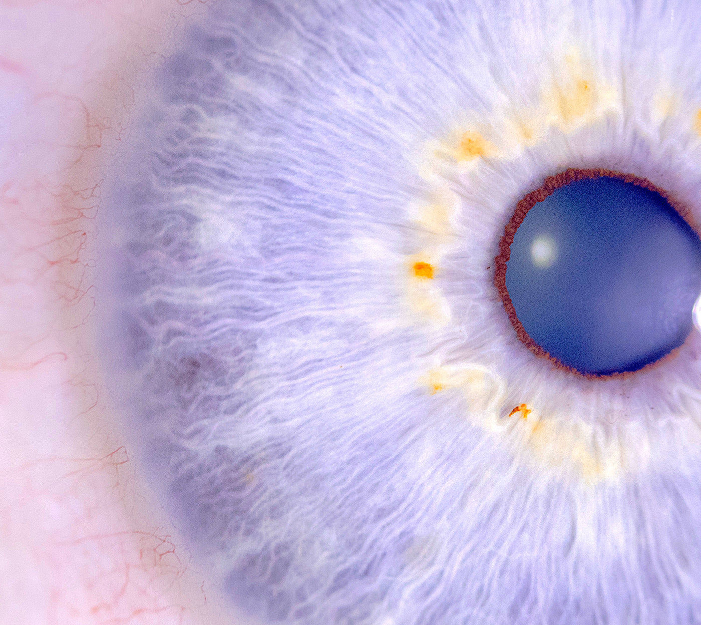 Camera Iriscope | Iridoscope | Iris Lighting | Professional iridology